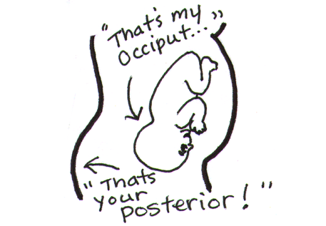 Can you change your babies position from ROP (Right Occiput Posterior ...